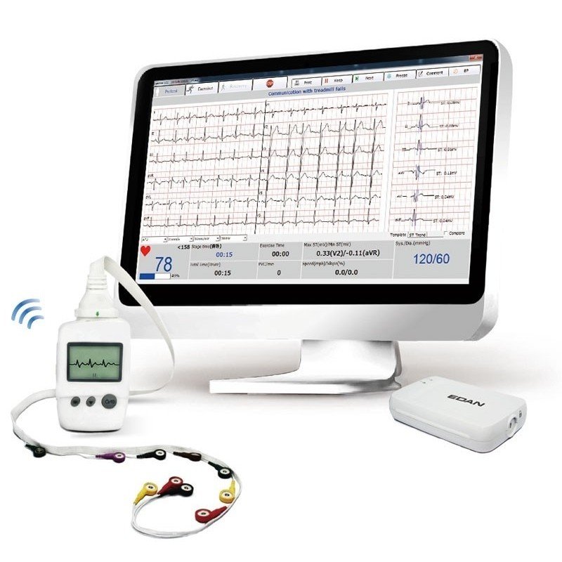 electrocardiographe ecg