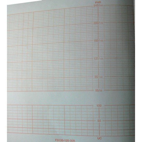 electrocardiographe ecg
